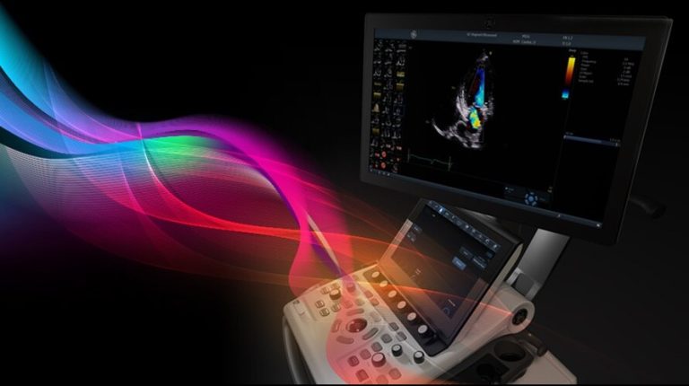 vivid-s70n-imagegallery01 | Ascent CardiologyAscent Cardiology